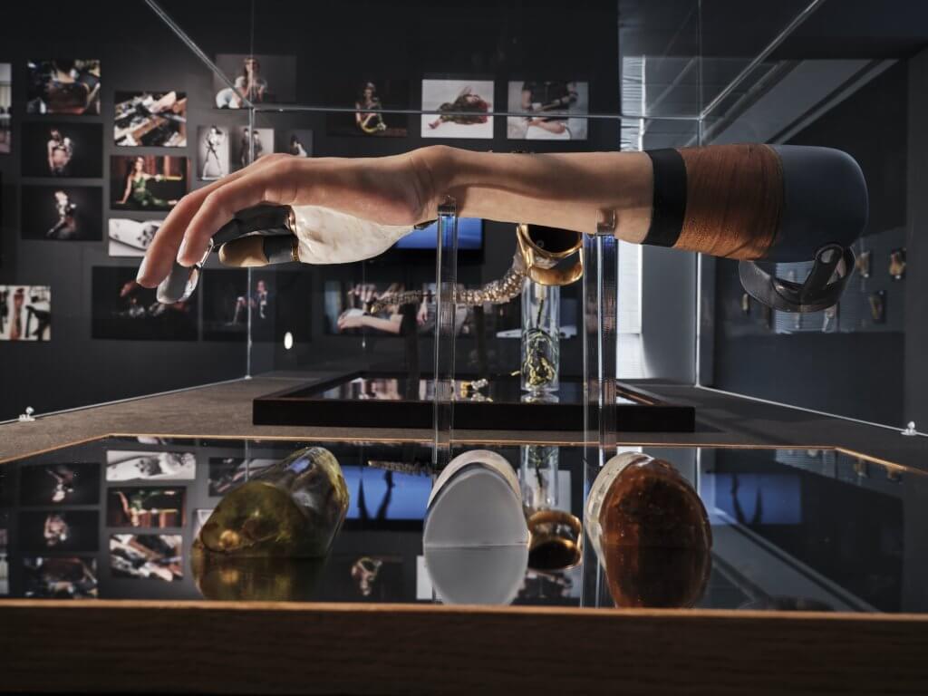 Anatomy of Fragility – Body Images in Art and Science | Frankfurter ...
